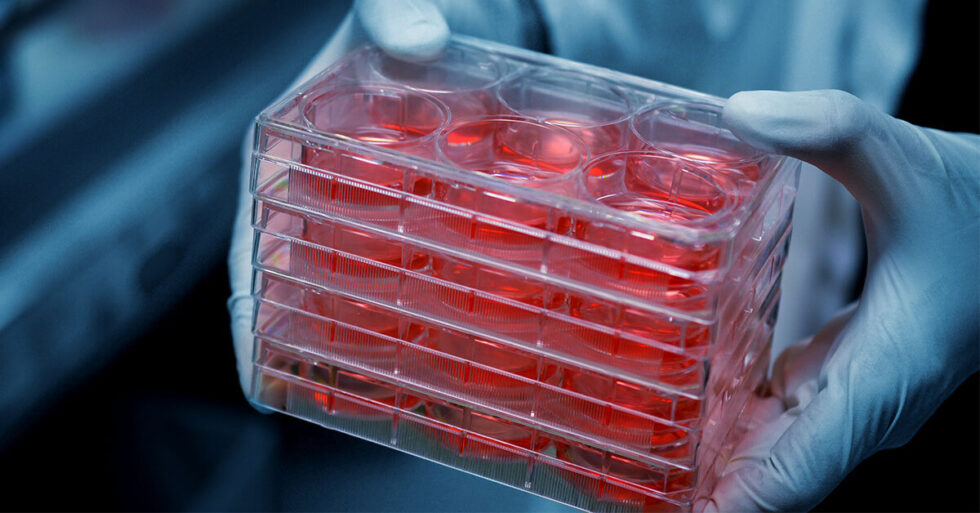 Organoid Culture Enables New Frontiers In Therapeutic Research | Nucleus Biologics